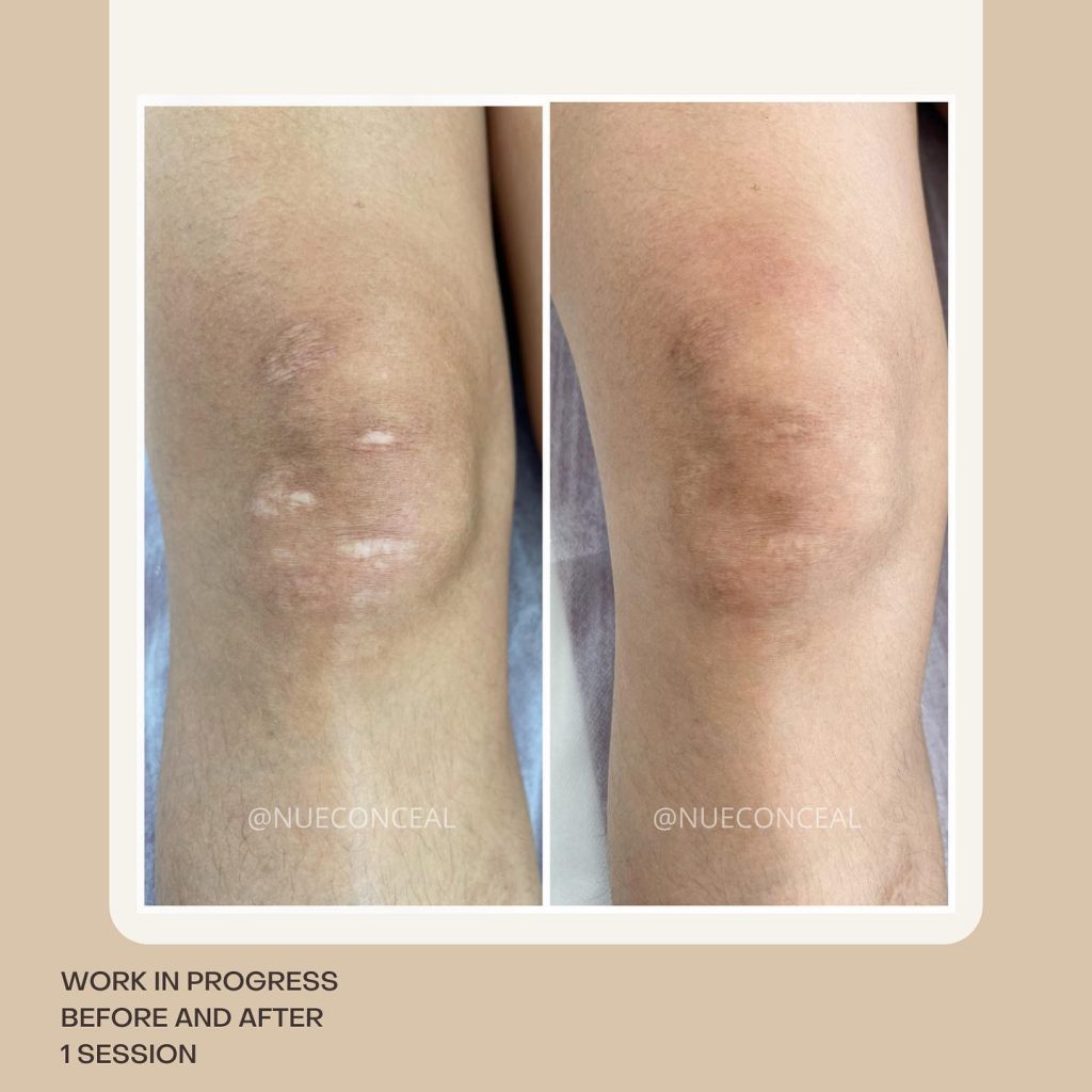 Paramedical Tattooing - ROMATHERAPY SALON & SPA Milton WV