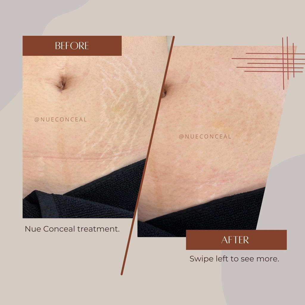 Paramedical Tattooing - ROMATHERAPY SALON & SPA Milton WV